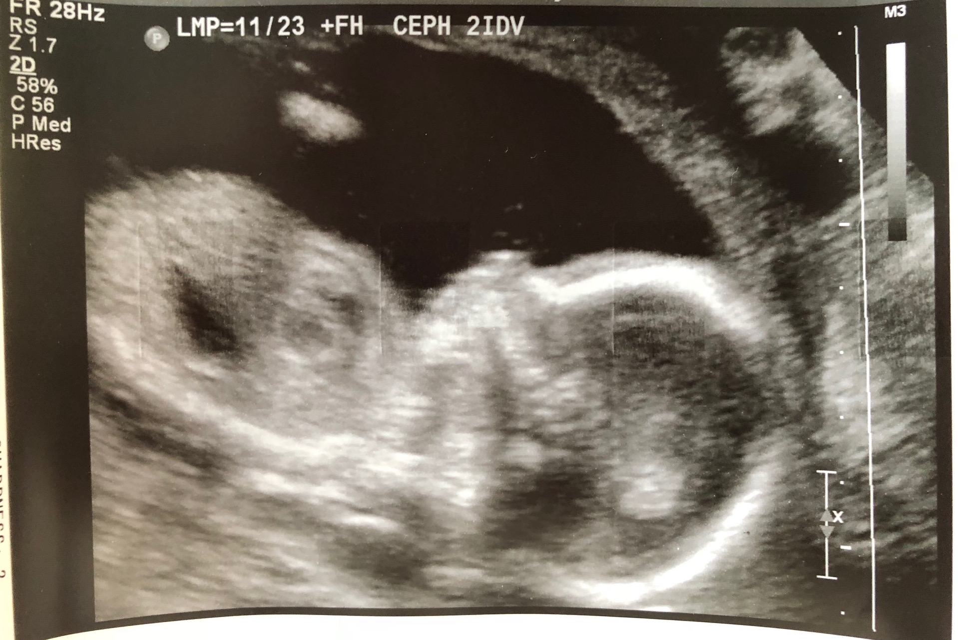 Second Trimester Recap - Andie Mitchell